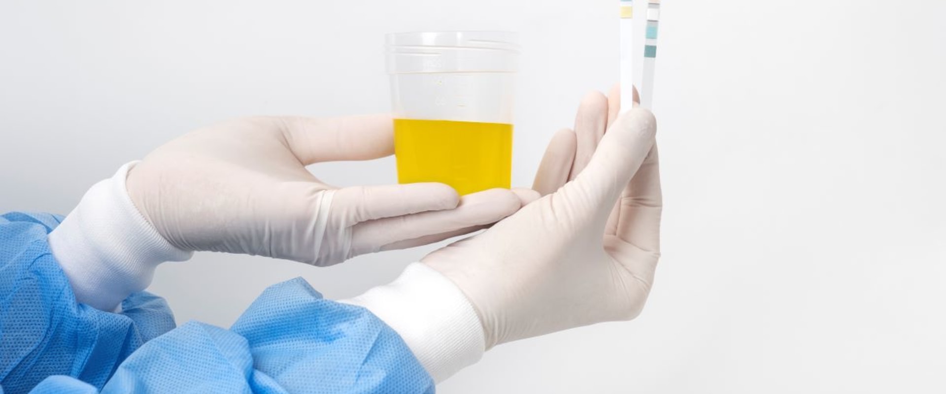 Urine Tests: Overview and Benefits
