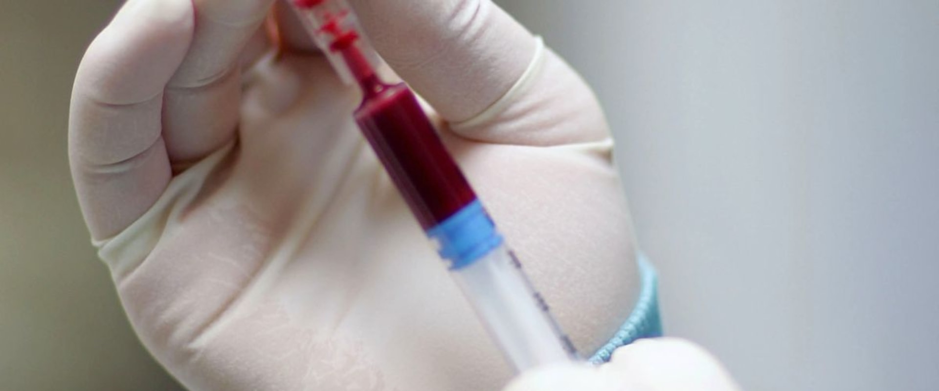Blood Tests: What You Need to Know